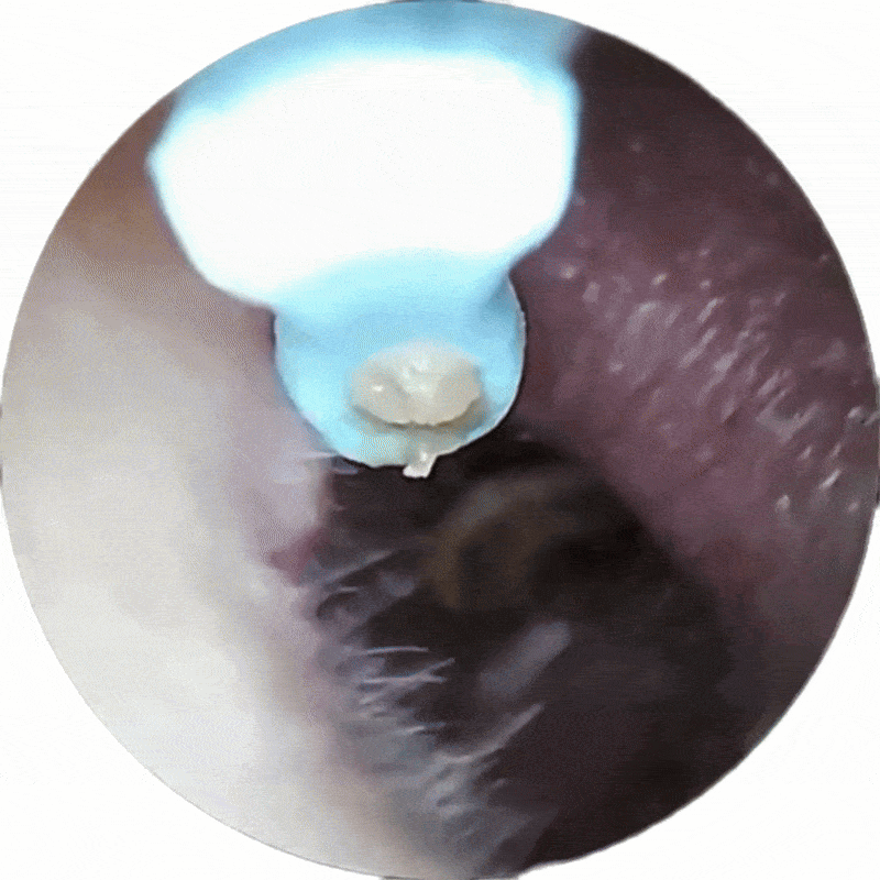 7 Disgusting Things Hiding In Your Ears Right Now (Even If You Clean ...