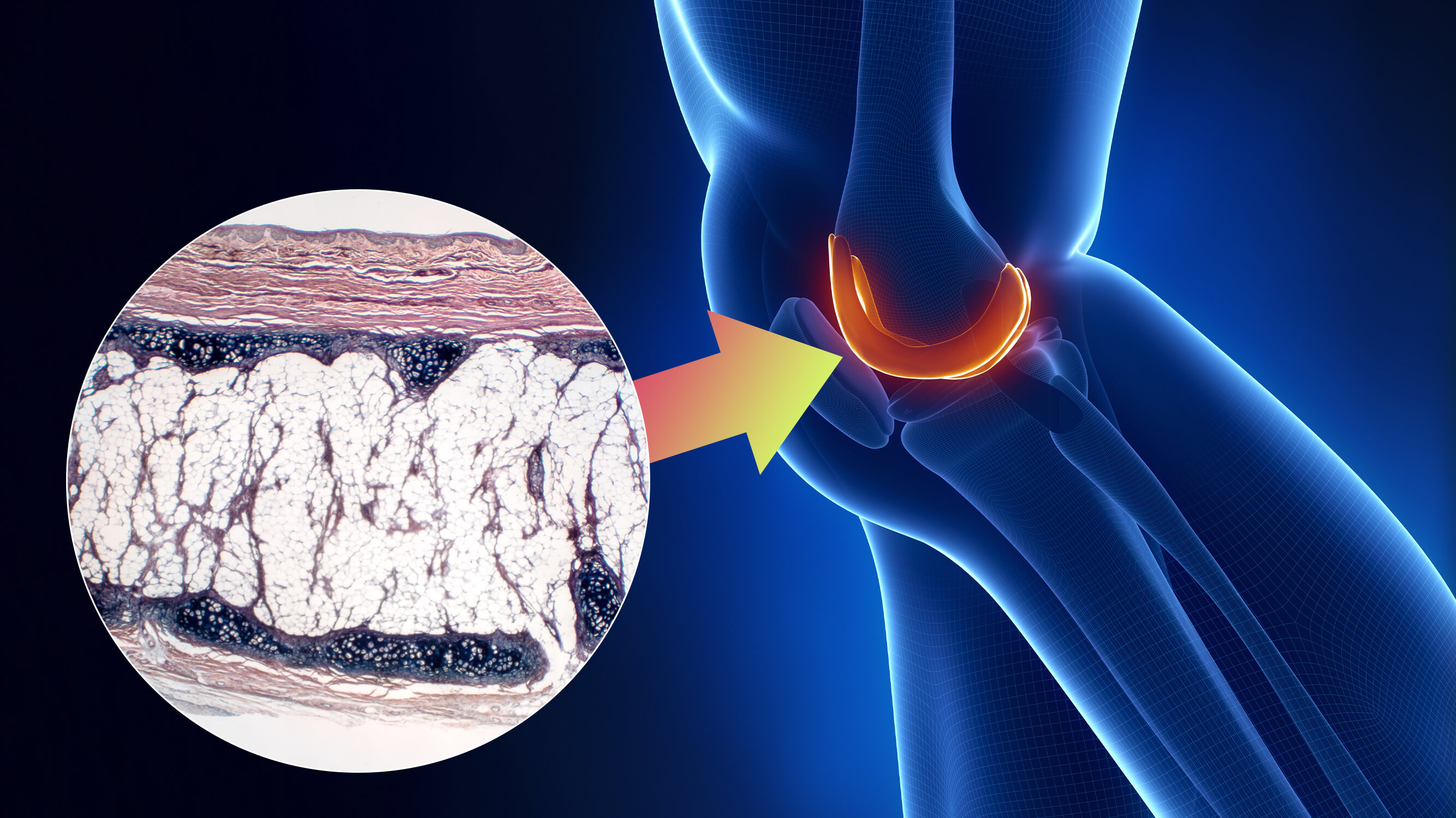 Can Cartilage Regrow? | Upwellness – UpWellness