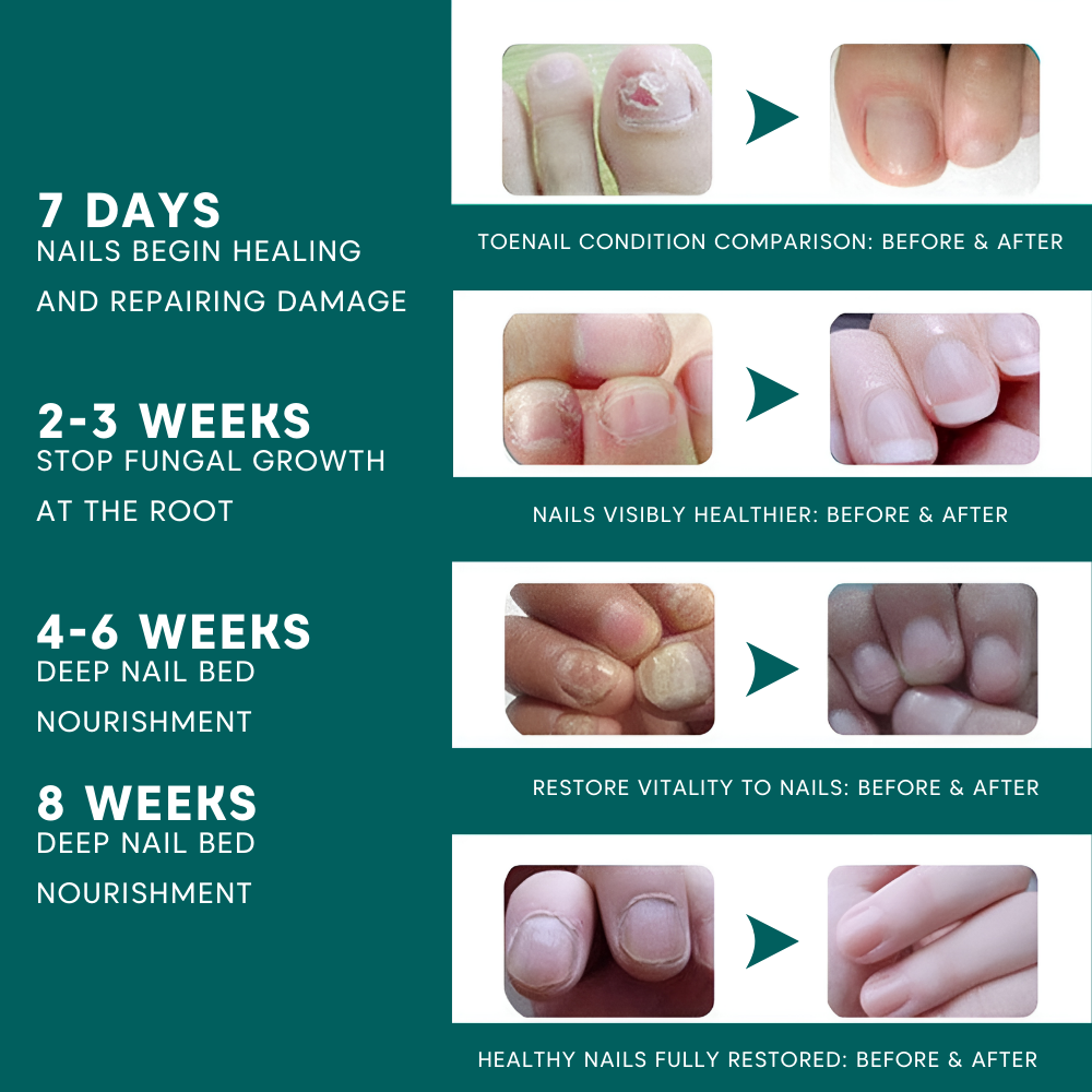 Nail Care Pen – Mullend